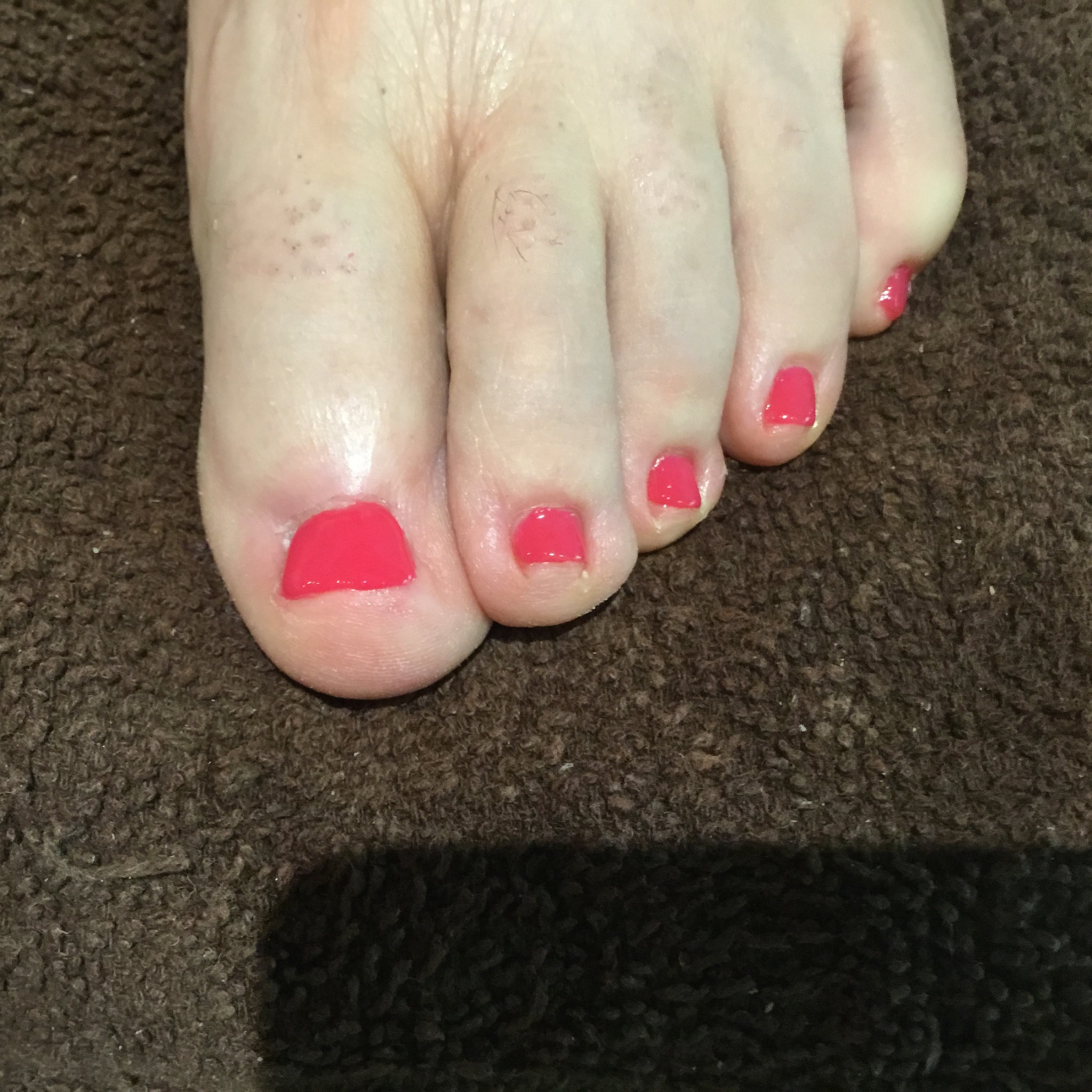 Toenail Reconstruction | L'Arte Delle Mani